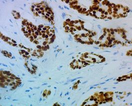 5HMC to ARID - IHC Control Slides