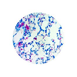 Histology Stain Kit-Fite's (Leporosy & Nocardia Procedure)-Includes ...