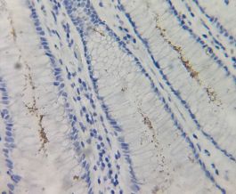 HPL: Helicobacter Pylori IHC Control Slides