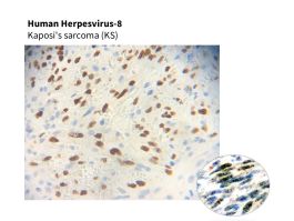 HHV8 -human herpes virus 8 IHC Control Slides