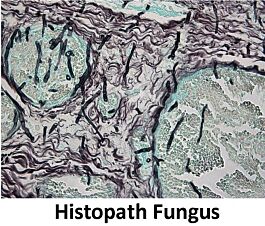 Control Slides, Histopath Fungus, Box/98 slides, plus 2 pre-stained ...