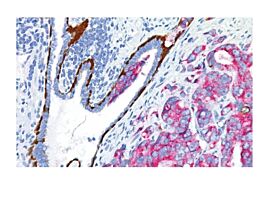 Prostate Multiplex Marker Control Slides, PIN4 (CK5/14+P63+P504S), Box ...