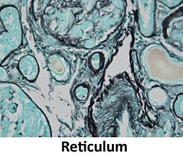Control Slides, Reticulin, Box/20 slides, plus 2 pre-stained slide ...