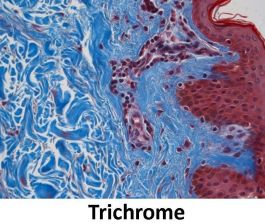 Control Slides, Trichrome, Box/98 slides, plus 2 pre-stained slide ...