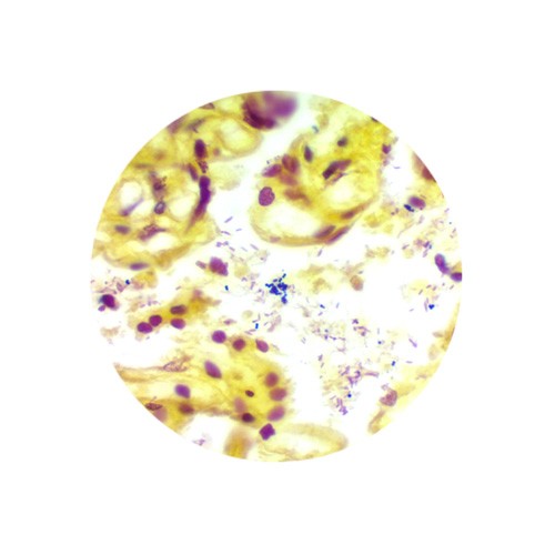 Special Staining Kits Ready To Ship